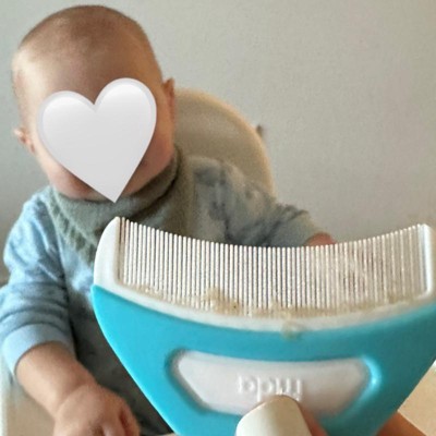Frida Baby Dermafrida The Flakefixer 3-step Cradle Cap System : Target