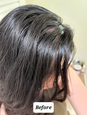 Dove Beauty Rose Bloom Dry Shampoo - 5oz : Target