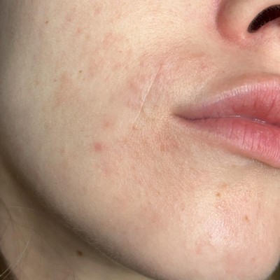 Flamingo Women's Face Wax Kit - 20ct : Target