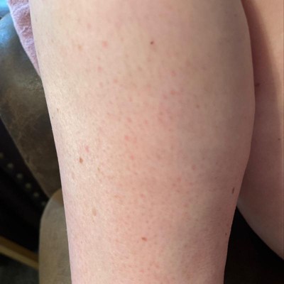 Schick Skintimate Sensitive Skin Women's Disposable Razors - 4ct : Target