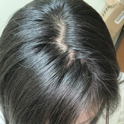 The Honest Company Sensitive Shampoo + Body Wash Fragrance Free - 10 Fl ...