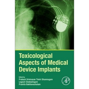 Toxicological Aspects of Medical Device Implants - by Prakash ...
