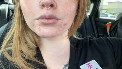 Byoma Balancing Face Mist - 3.38 Fl Oz : Target