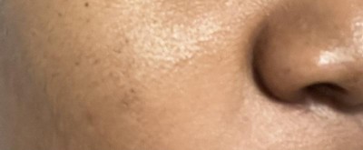 Hero Cosmetics Pore Release Facial Treatment- 3.38 Fl Oz : Target