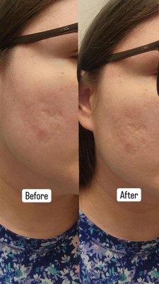 Physicians Formula Mineral Wear Diamond Perfector Bb Cream - 1.2 Fl Oz ...