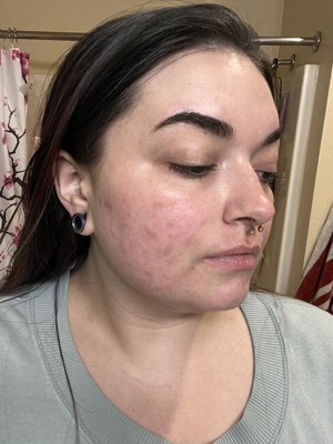 Sunday Riley Good Genes All-in-one Lactic Acid Treatment Serum - 1 Fl ...