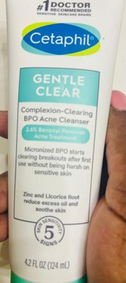 Cetaphil Gentle Clear Complexion Bpo Acne Face Wash- 4.2 Fl Oz : Target