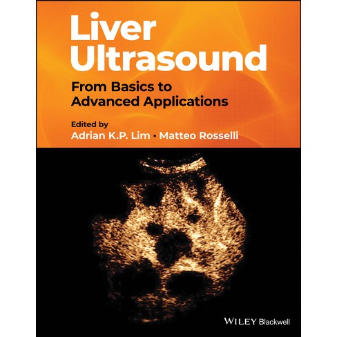 Liver Ultrasound - By Adrian K P Lim & Matteo Rosselli (hardcover) : Target