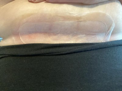 Lansinoh C-section Recovery Pads - 4ct : Target