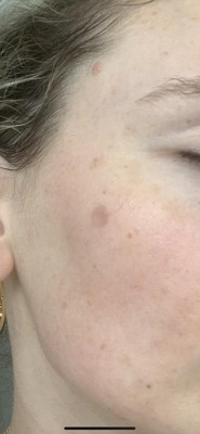 Naturium Niacinamide Serum 12% Plus Zinc 2% - 1 Fl Oz : Target