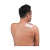 Lidocaine 4% Pain Relieving Gel Patch - 6ct - Up & Up™ : Target