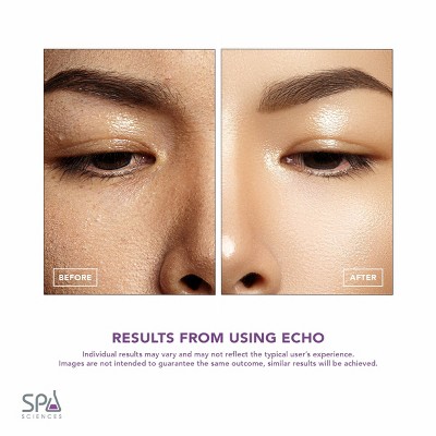 Spa Sciences Echo Sonic Makeup Brush With Antimicrobial Bristles - White : Target