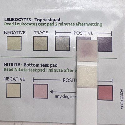 Azo Urinary Tract Infection Test Strips, Uti Test Results In 2 Minutes ...