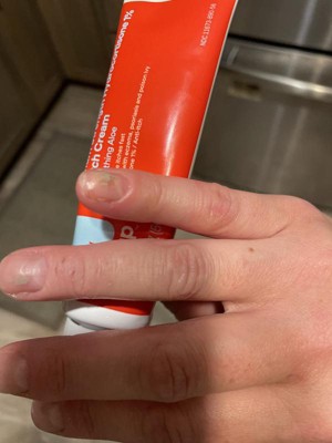 Anti-itch 1% Hydrocortisone Maximum Strength Cream With Aloe - Up&up ...