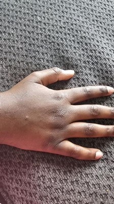 Cerave Itch Relief Moisturizing Lotion For Dry And Itchy Skin Unscented ...