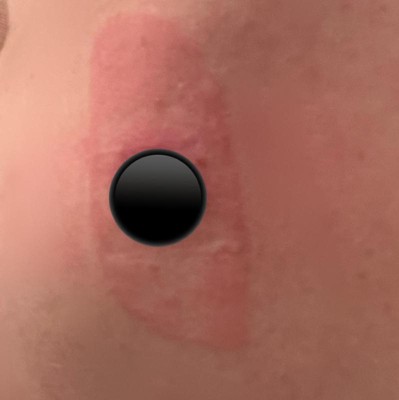 Band-aid Sensitive Skin Adhesive Bandages - 20ct : Target