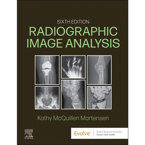 Radiographic Image Analysis - 6th Edition By Kathy Mcquillen Martensen ...