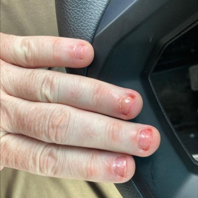Orly No Bite Nail Bite Deterrant - .6 Fl Oz : Target