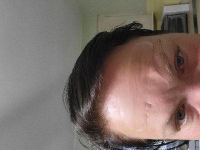 Hero Cosmetics Forehead Mighty Patch - 5ct : Target