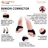 Copper Joe Big Toe Bunion Corrector Sleeves Ultimate Copper Infused ...