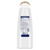 Dove Beauty Dermacare Anti-dandruff Shampoo - 12 Fl Oz : Target