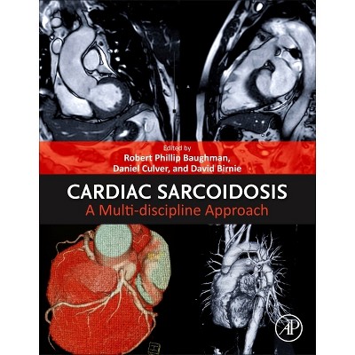 Cardiac Sarcoidosis - by Robert Phillip Baughman & Daniel Culver ...