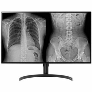 LG 32HL512D-B 31.5" 3840x2160 4K LCD IPS 5ms HDMI DisplayPort Monitor ...