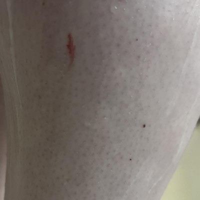 Flamingo 5-blade Women's Razor - 1 Razor Handle + 2 Razor Blade Refills ...