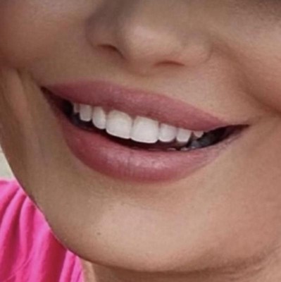 Ismile Led Teeth Whitening Kit White : Target