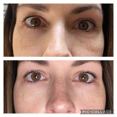 Hero Cosmetics Mighty Patch For Tired Eyes - 6ct : Target