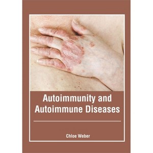 Autoimmunity and Autoimmune Diseases - by Chloe Weber (Hardcover) : Target