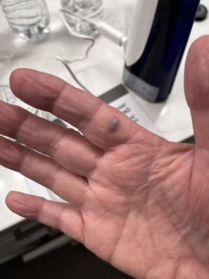 Waterpik Cordless Water Flosser : Target