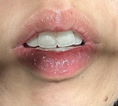 Eos Extra Dry Lip Repair Tube - 0.7 Fl Oz : Target