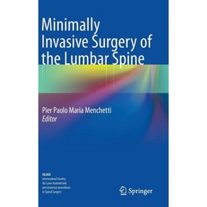 Minimally Invasive Surgery of the Lumbar Spine - by Pier Paolo Maria ...