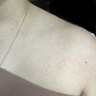 Boie Usa Exfoliating Body Scrubber - Pink : Target