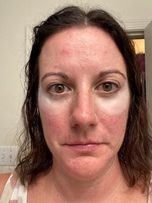 Hero Cosmetics Mighty Patch For Tired Eyes - 6ct : Target