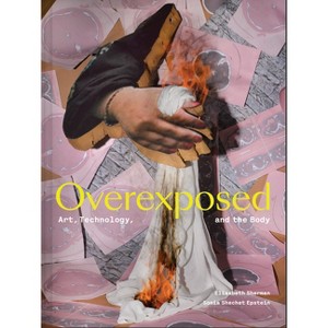 Overexposed - by Elisabeth Sherman & Sonia Shechet Epstein (Hardcover ...