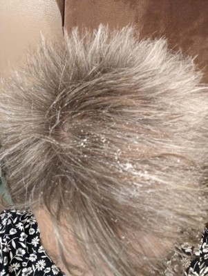 Aussie Mega Hair Spray - 10oz : Target