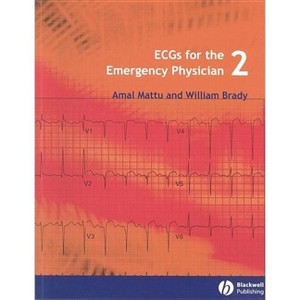 Ecgs for the Emergency Physician 2 - by Amal Mattu & William J Brady ...