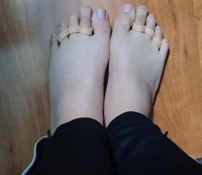 Zentoes Triple Loop Toe Crest For Hammer Toes - Beige - 2pk : Target