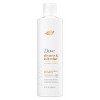 Dove Beauty Dermacare Anti-dandruff Shampoo - 12 Fl Oz : Target