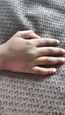 Cerave Itch Relief Moisturizing Lotion For Dry And Itchy Skin Unscented ...