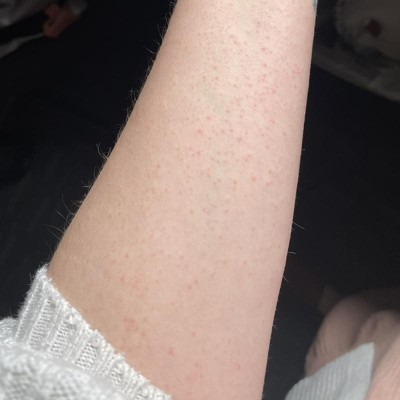 Boie Usa Exfoliating Body Scrubber - Pink : Target