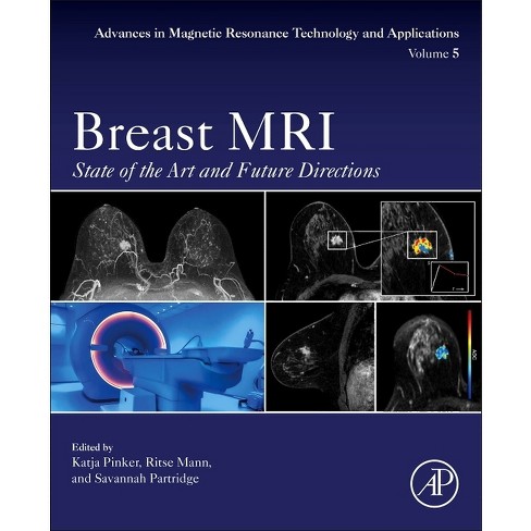 Breast Mri - (advances In Magnetic Resonance Technology And ...