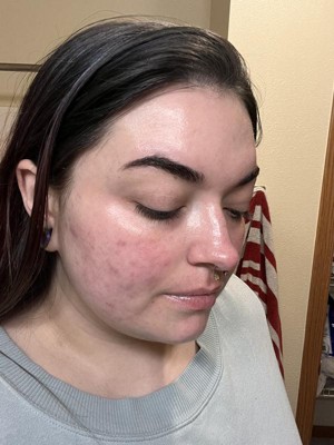 Sunday Riley Good Genes All-in-one Lactic Acid Treatment Serum - 1 Fl ...