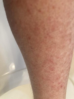 Gold Bond Age Defense Hand And Body Lotion Ultimate Crepe Corrector ...