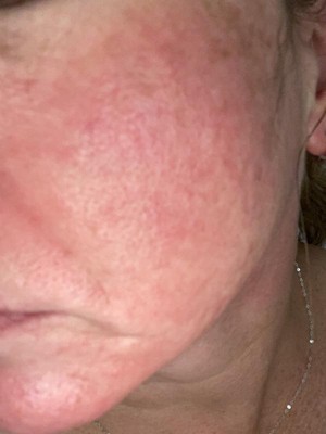 Nair Moisturizing Facial Hair Removal Cream With Sweet Almond Oil - 2 ...