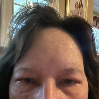 Roc Multi Correxion Revive And Glow Vitamin C Under Eye Balm - 0.14oz ...