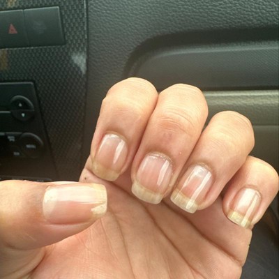 Nailtiques Formula 2 Nail Protein - 0.5oz : Target