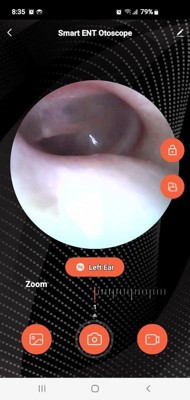 Mobi Ear Nose & Throat Smart Wi-fi Otoscope : Target